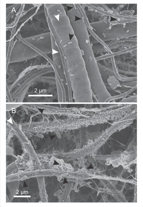 Sem Of Microorganisms Colonizing The Surface Of Calothrix Filaments