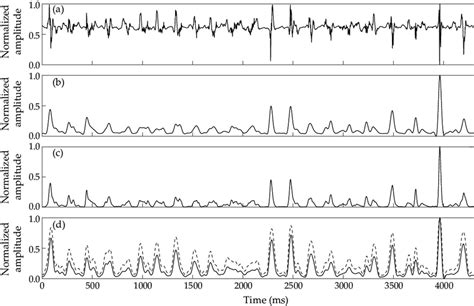 Comparative Analysis Of The Preprocessing Stage Of Each Of The Compared Download Scientific