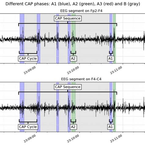 Cyclic Alternating Pattern With Its A Phases Red Blue And Green Download Scientific