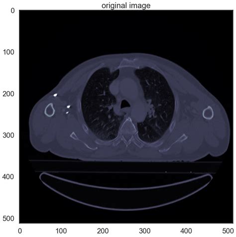 Imaging Module Tutorial Precision Medicine Toolbox