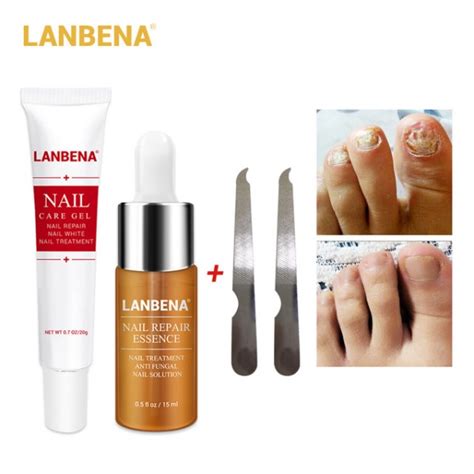 Средство для лечения ногтей Aliexpress LANBENA Nail Care Gel+Nail ...