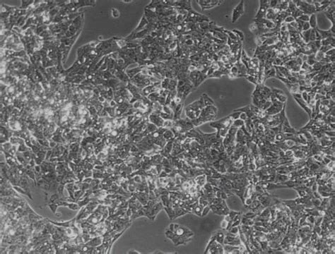 Figure 1 Example Of Hepg2 Cell Culture Appearance National Cancer