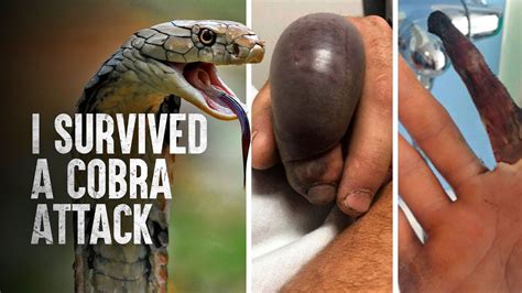 How To Survive A King Cobra Attack Youtube
