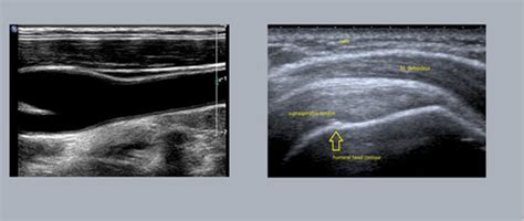 Transducer Selection Images Flashcards Quizlet Transducer Selection Images Flashcards Quizlet
