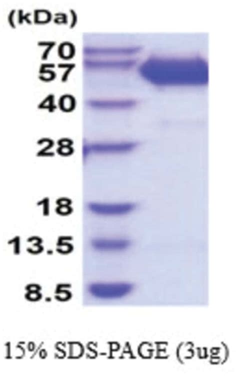 Novus Biologicals Recombinant Mouse Legumainasparaginyl Endopeptidase