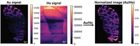 La Icp Ms Image Quality Can Be Improved By Utilizing Ho Signals For