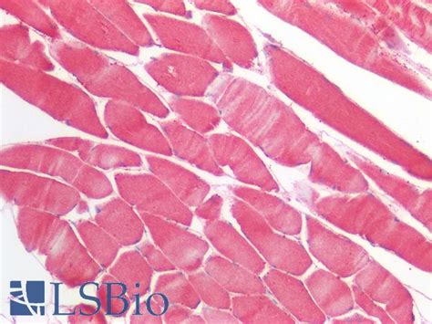 Ihc Plus™ Pgm1 Phosphoglucomutase 1 Monoclonal Antibody Mouse Lsbio