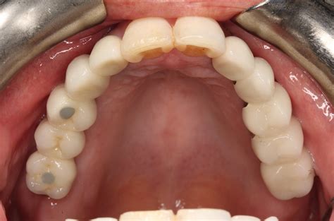 Cosmetic Restorative Cases — Ala Moana Dentistry