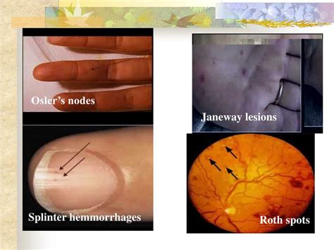 Ppt Inflammatory Disorders Powerpoint Presentation Free Download