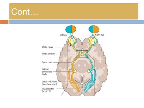 Visual Pathway And Its Defects Pptx Eye And Vision Conditions