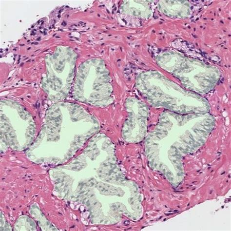 Prostate Gland Segmentation In Histology Images Via Residual