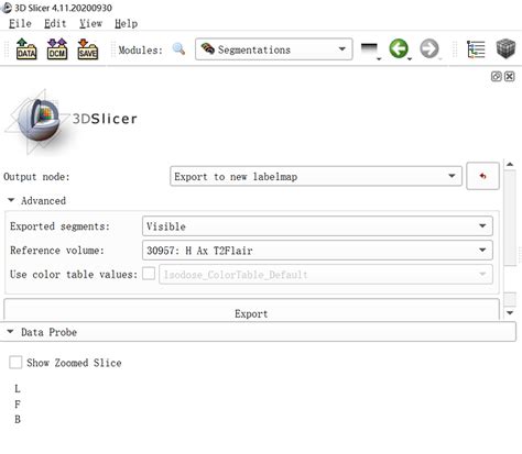 关于原图与label不匹配的问题 6，来自 Caoyufu 问题求助 3dslicer中文论坛