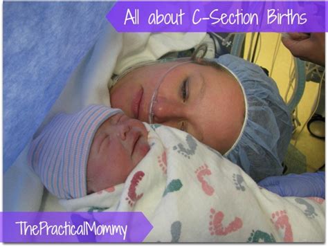 Having A C Section What You Should Know Hubpages