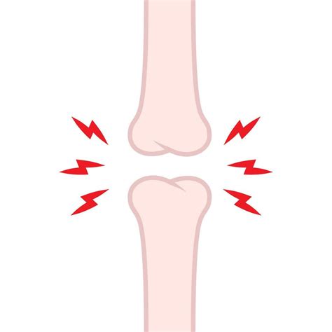 Knee Bone Problems Bone Cartoon 46888729 Vector Art At Vecteezy