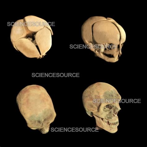 Human Skull Differences Human Anatomy Human Skull Collection Of