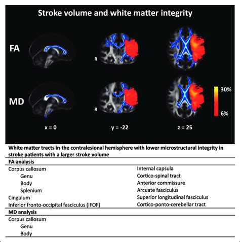 Voxel Wise Analysis Of The Fractional Anisotropy Fa Negatively