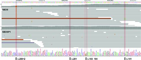 Aligned Ngs Reads From Wes Data Top And Sanger Sequencing Peak Map Download Scientific