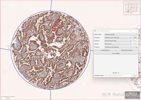 【笔记】qupath用于免疫组化定量评估 知乎