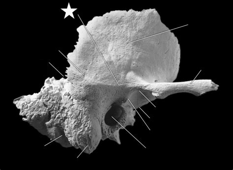 Skeleton The Temporal Bone Flashcards Memorang