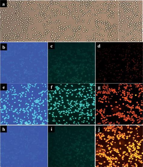 Microscopic Imaging Of Baker Yeast Cells Under Different Wavelengths Download Scientific