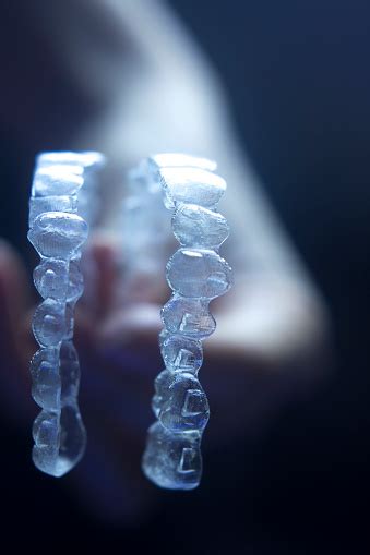 교정 되는가 괄호 및 Aligners 치과 브래킷 Aligner Sytraightener 건강관리와 의술에 대한 스톡 사진 및 기타 이미지 Istock