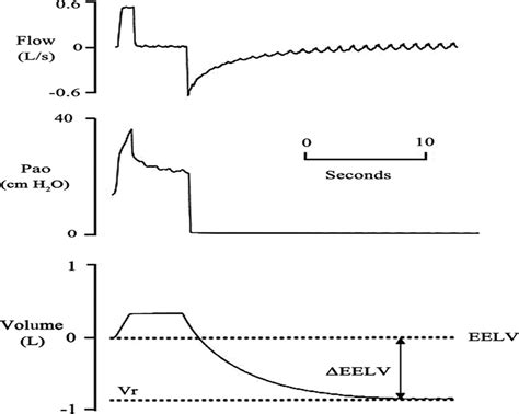 Anesthesiology Anesthesiology