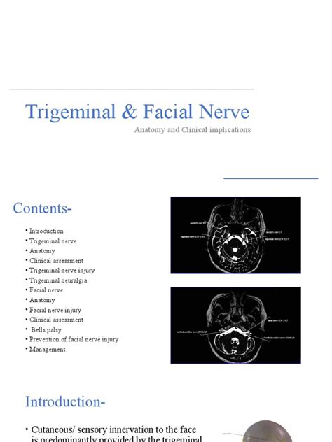 Trigeminal And Facial Nerve Overview Pdf Human Anatomy Human Head