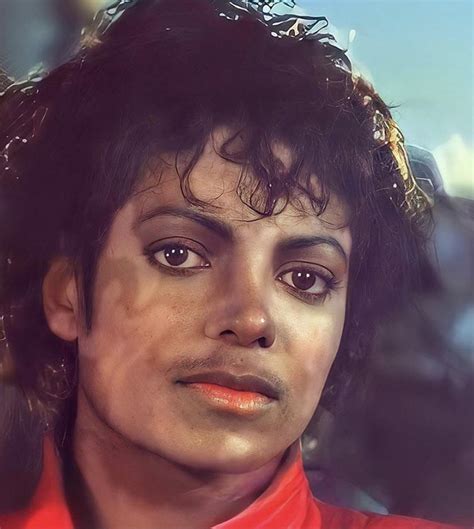 Vitiligo Michael Jacksons Skin Condition Hysk
