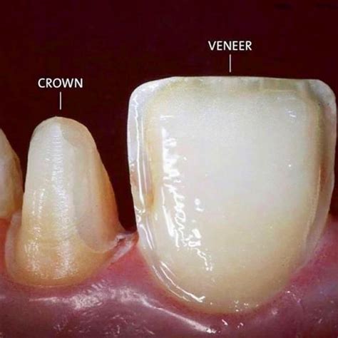 Dr Malissa Frederique Dr Malissa • Instagram Photos And Videos