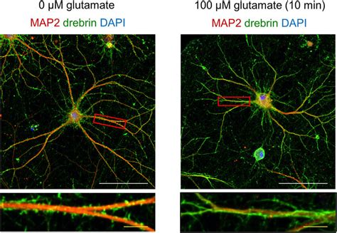 The Effect Of Glutamate Treatment On Mature Tf Induced Ipsc Neurons The Download Scientific