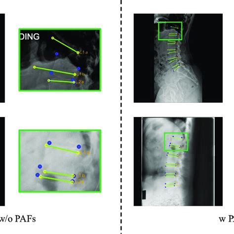 Results Of Landmark Detection With Or Without Pafs The Blue Circles