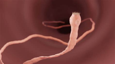 Pictures Of Tapeworms