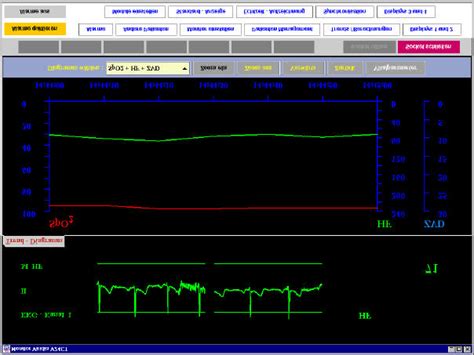 The Trend Diagram Of The Vital Parameters Download Scientific Diagram