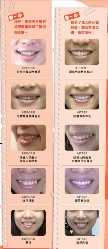 直擊！金泰熙完美女神的微笑秘密＠《整形達人》的新聞台｜pchome Online 個人新聞台