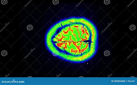 Mri Brain Scan Magnetic Resonance Image Ct Scan Of Human Brain In