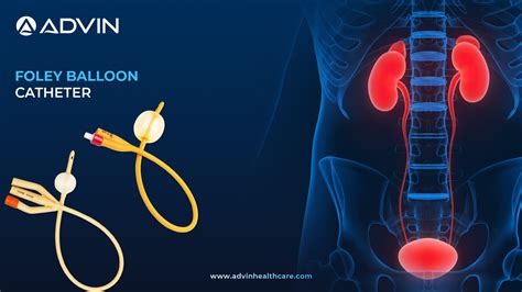 Indwelling Catheter Balloon Size