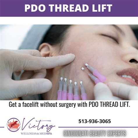 Pdo Thread Lift Artofit