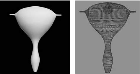 Figure 3 From A Visual Graphichaptic Rendering Model For Hysteroscopic