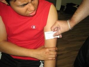 Environmental Emergencies Insect Stings And Snake Bites