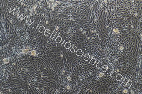 小鼠原代腹膜间皮细胞 原代细胞 Str细胞 细胞培养基 镜像绮点生物