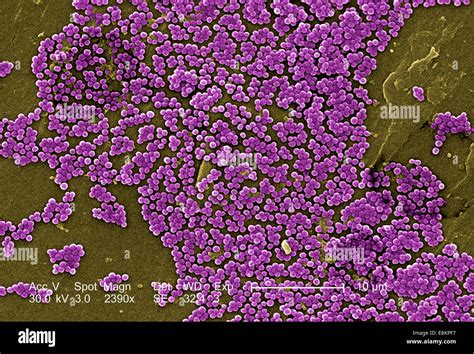 This Colorized Scanning Electron Micrograph SEM Depicted Numerous Clumps Of Methicillin