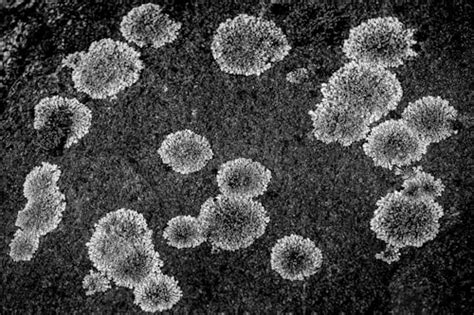 Cytopathic Effect In Virology A Comprehensive Guide