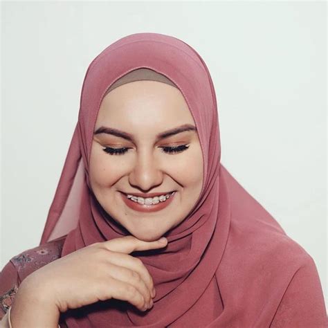 6 Potret Terbaru Irish Bella Tampil Pakai Behel Ingin Hilangkan