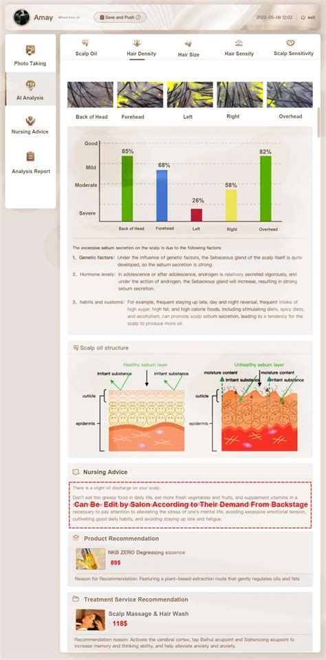 Stop Hair Loss Now Smart Scalp Analyzer For Perfect Transplants