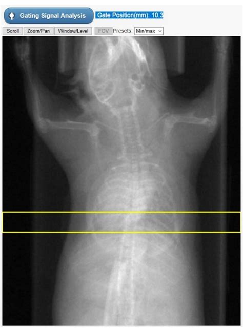 High Resolution Cardiac Positron Emission Tomographycomputed