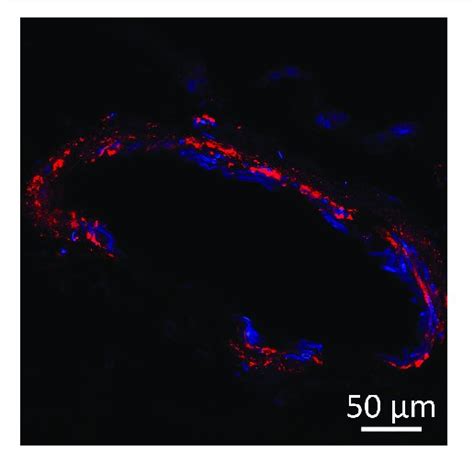 Amyloid Beta Red Detected By Immunofluorescence Staining In The