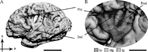 A The Left Hemisphere Of A Human Brain With The Opercula Of The