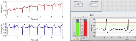 figure 9 from design and implementation of portable electrocardiogram