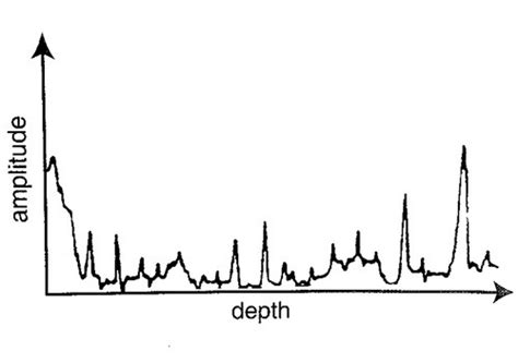 Module 4 Principles Of Pulse Echo Imaging Flashcards Quizlet