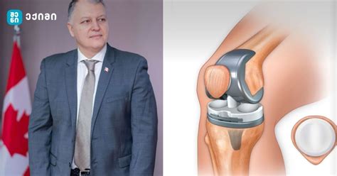 ვიტამინი D იმაზე ბევრად მეტია ვიდრე მზე და ძვლები